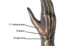 Rhizarthrose ou arthrose du pouce - Groupe Clinique Drouot