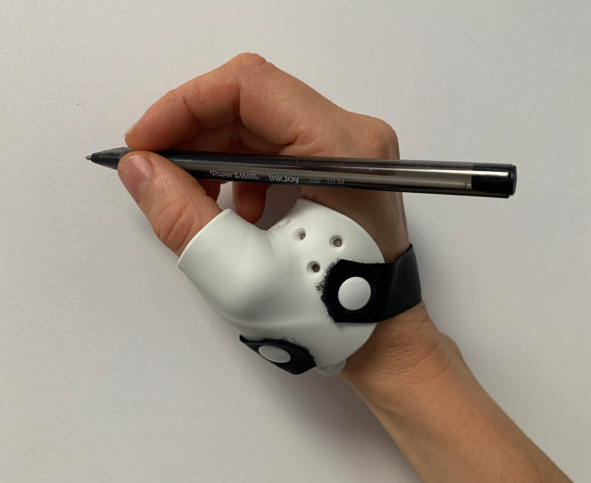 Les orthèses sur mesure de la main - Groupe Clinique Drouot